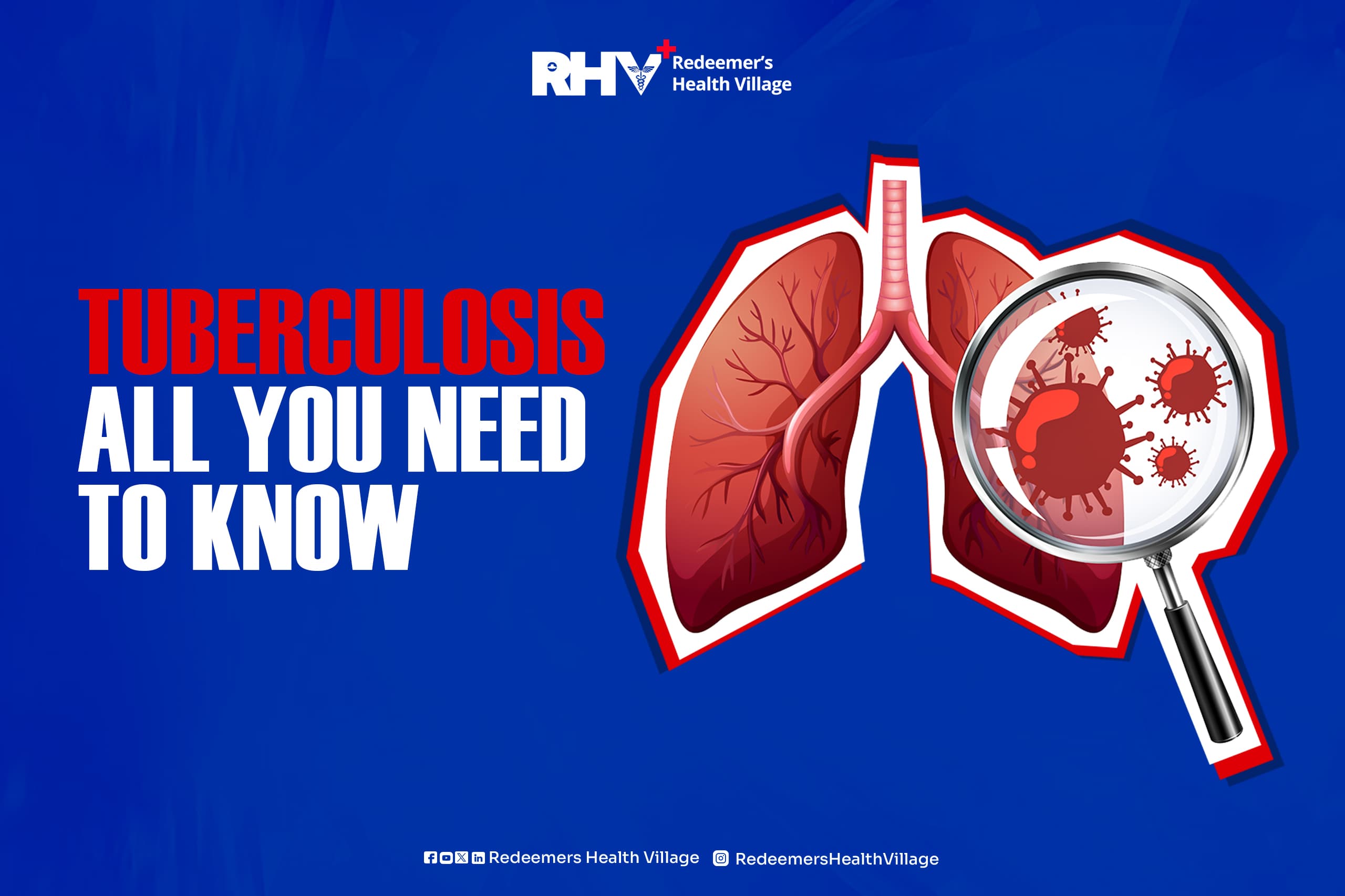 Tuberculosis (TB): All You Need to Know - RHV